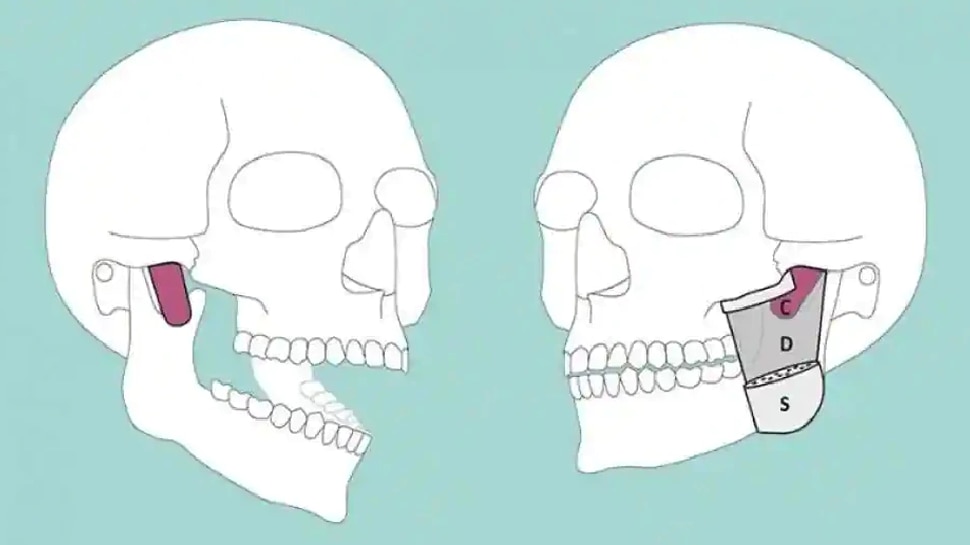 The greatest discovery of the century, the new body part in front of ...