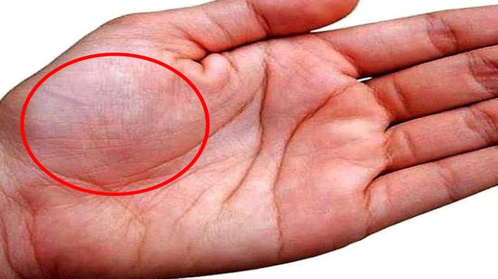 mole on your hand are sign of your life and stars change know what you ...