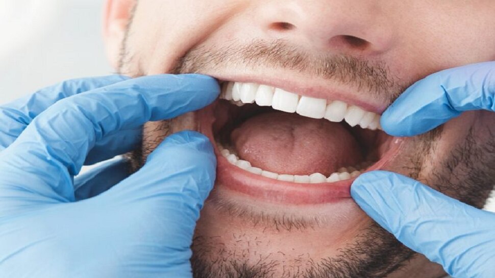 informative news does wisdom teeth or akkal dadh can makes you more ...