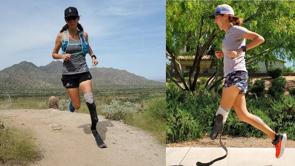 a success story of cancer lost a leg but she set a running record in ...