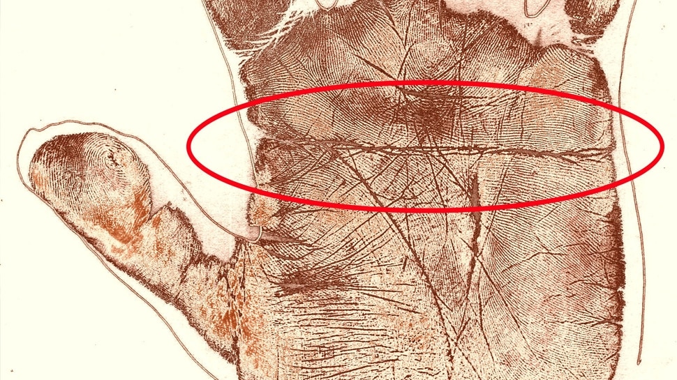 Simian Line On Palm signifies wealth health and success