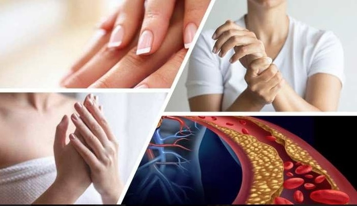 Health News High : Cholesterol warning signs and 3 common symptoms in hands