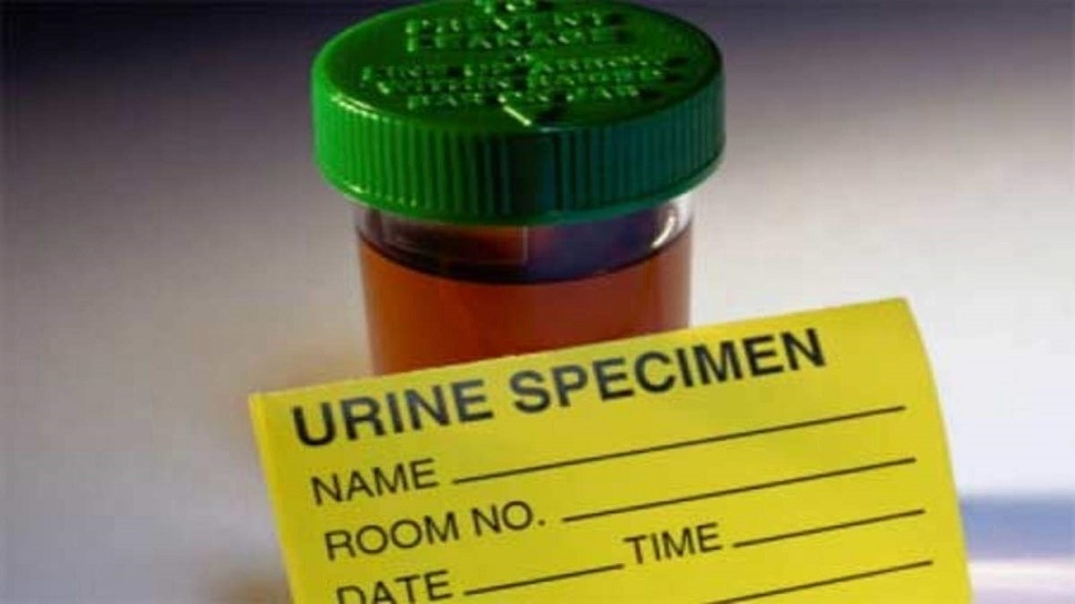 Urine colour and its meaning for both male and female read all colour chart