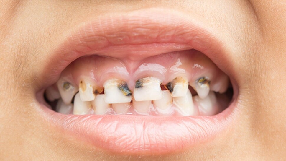 Herbal Tooth Powder: Worried about getting worms in your teeth? Make ...