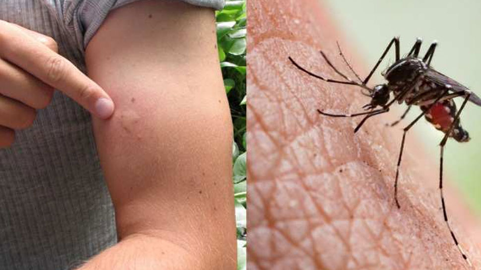 mosquito bite reason why mosquito bite gives dengue and malaria