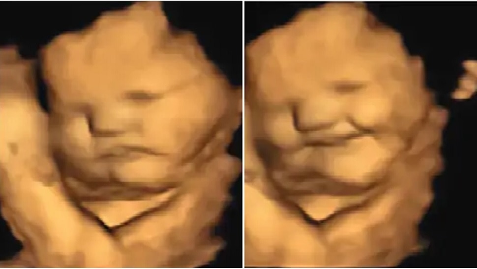 Expression given by the unborn child on the taste of food Taken By Mother