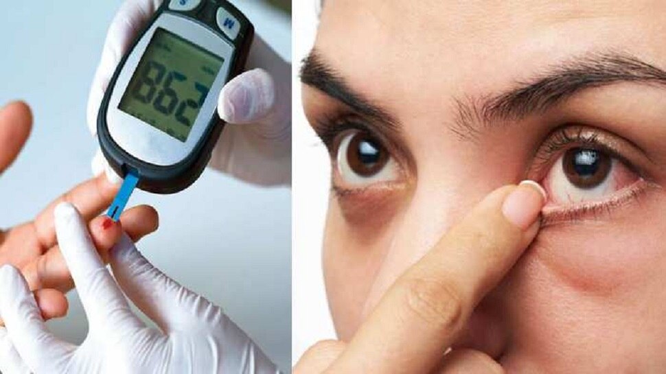 Early Signs of Type 2 Diabetes: Recognize these early symptoms of type ...