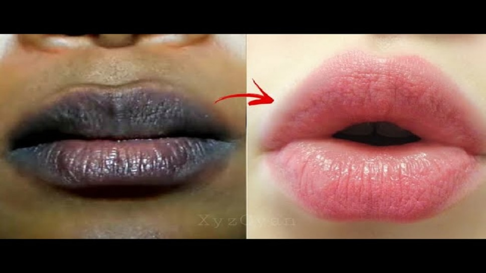 how to get rid of dark lips and get pink soft lips naturally jmp