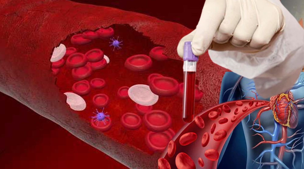 Blood News : Lab blood given to humans in a world first clinical lab ...