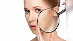 home remedies to remove dead skin cells from face News in Marathi, home ...