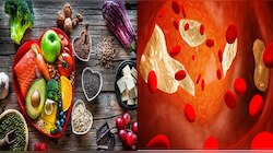 cholesterol badhane ke lakshan News in Marathi, cholesterol badhane ke ...