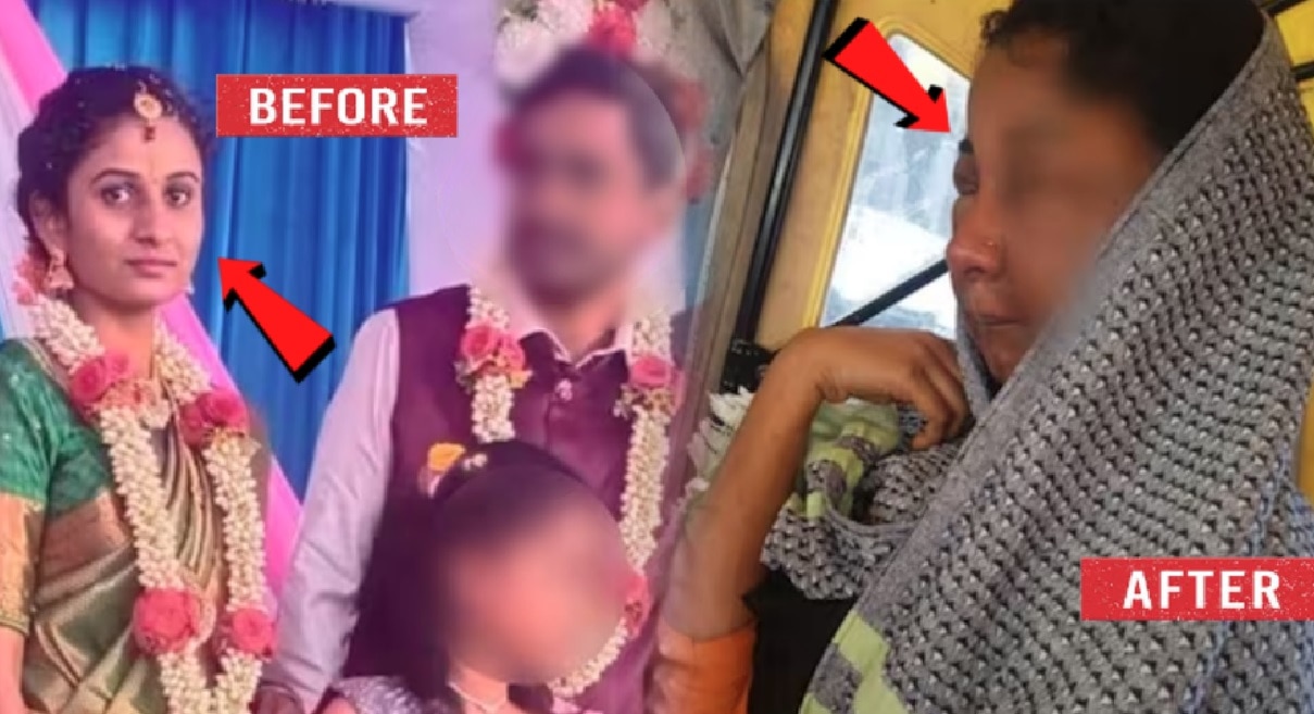 Face Disfigured By Makeup: लग्नाआधी मेकअपसाठी गेली आणि घरी येईपर्यंत ...