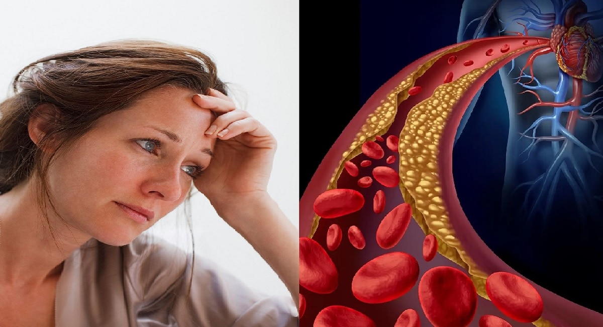 What is level of high cholesterol in Women