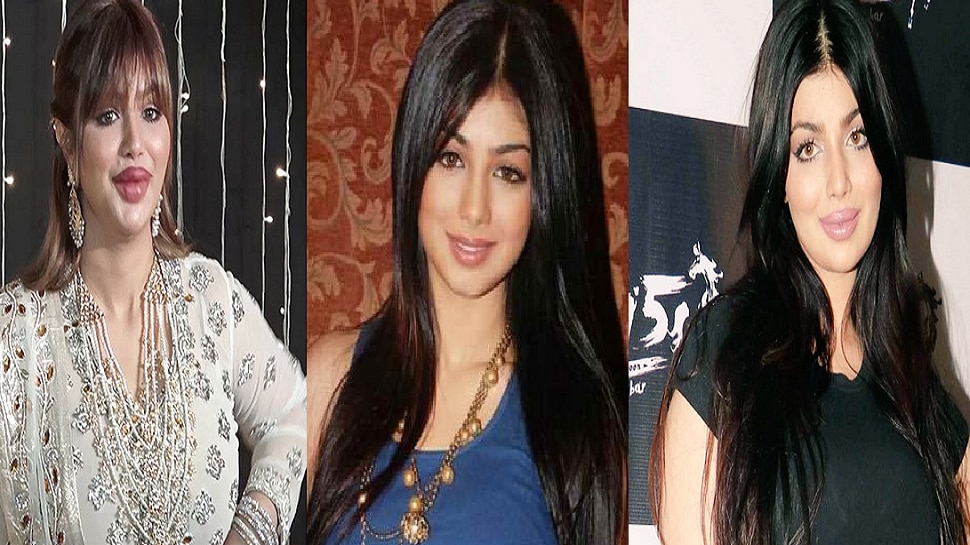 Ayesha Takia face was so bad after surgery her lips were swollen no one ...