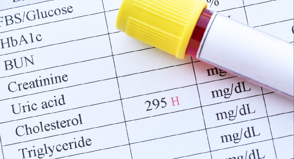 Cholesterol Level शरीरातील कोलेस्ट्रॉल लेव्हल किती असायला हवी यापुढे