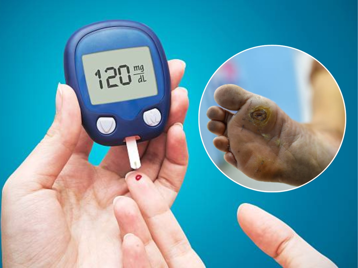 8 Dangerous symptoms of last stage diabetes in men and women; शरीरातील ...