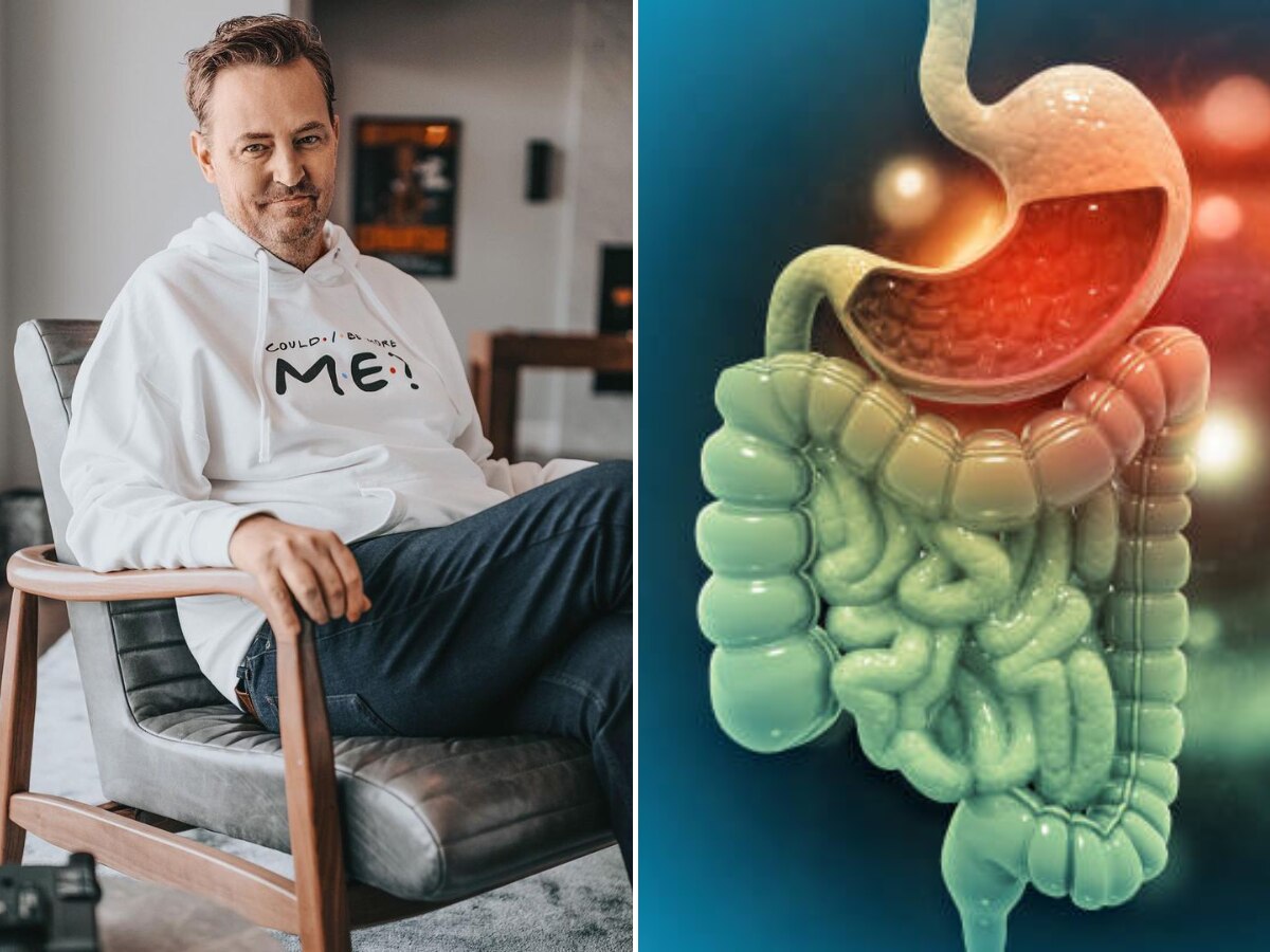 Matthew Perry death Real Reason what is Narcotic Bowel Syndrome ...