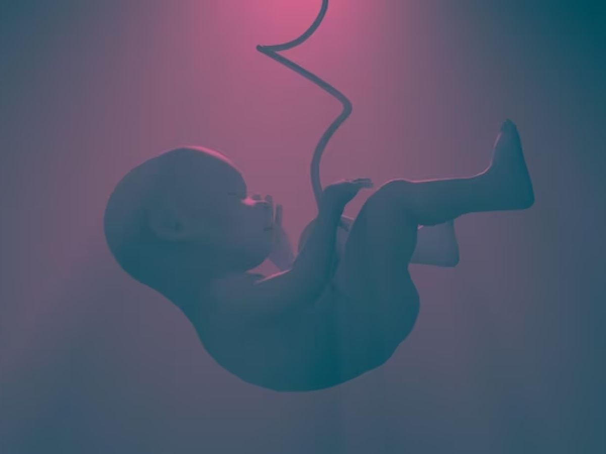 What is True Knot And It realy Dangerous for Baby in Womb; र्भात बाळाचं ...