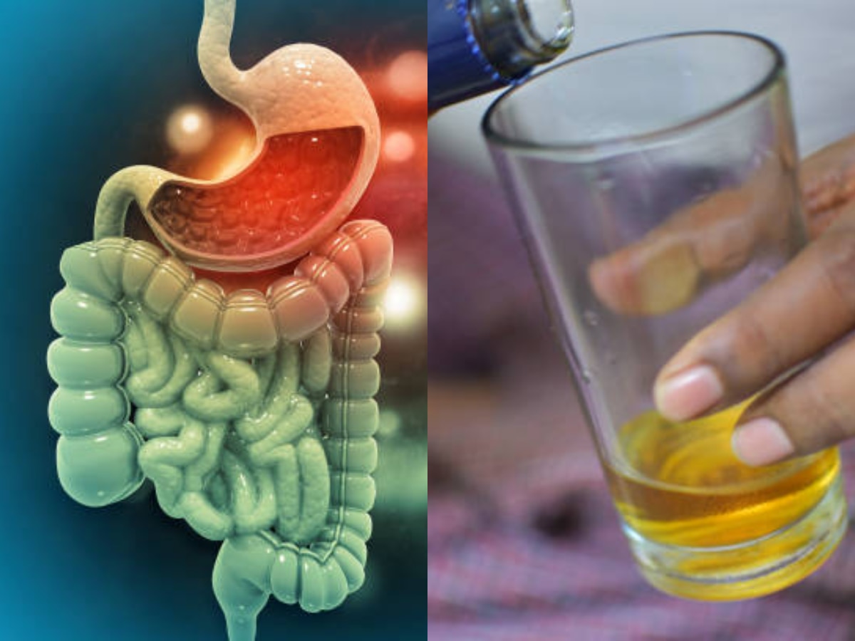How Alcohol Affects the Intestines And Its create Cancer Issue ...