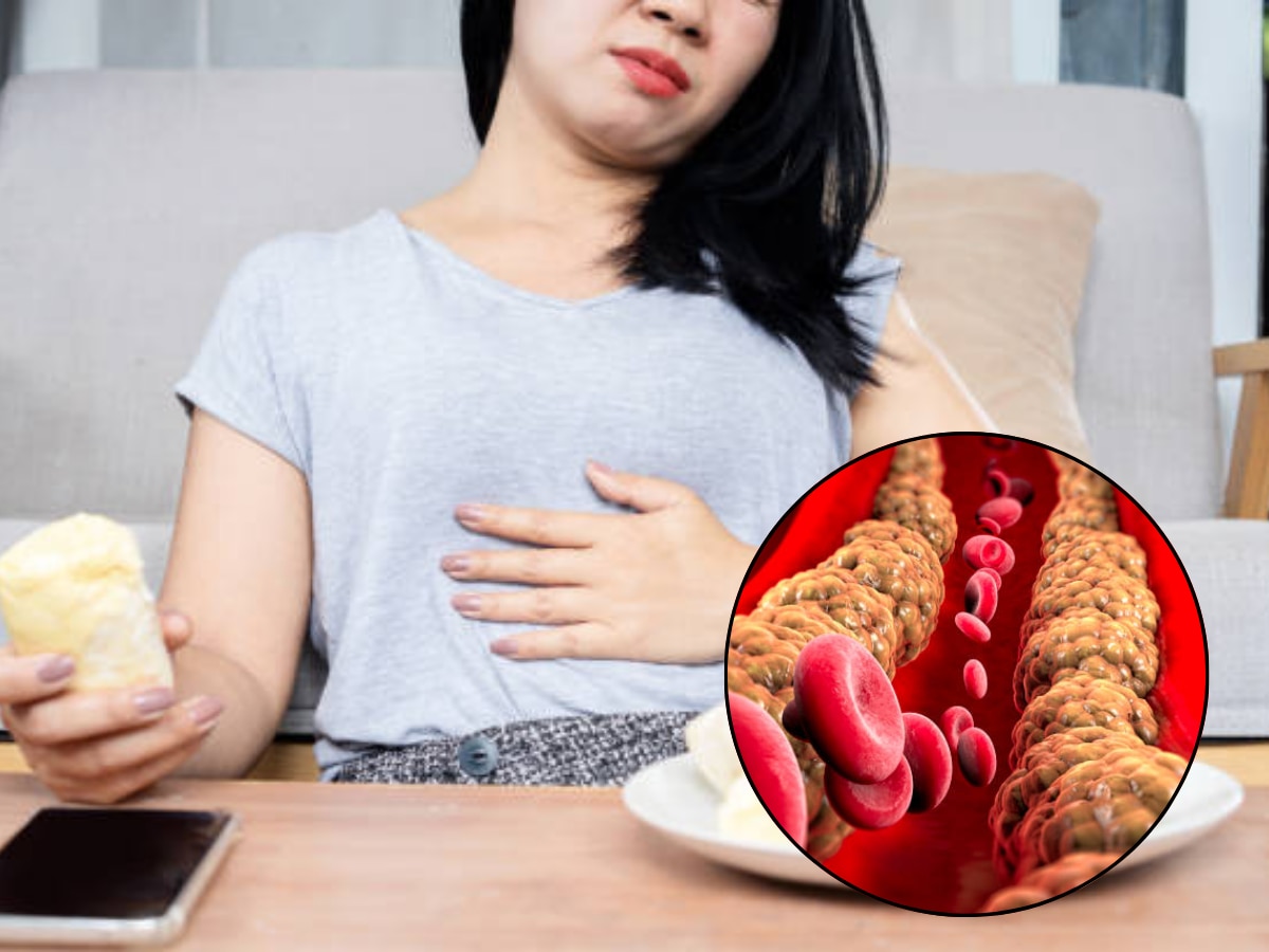 4 Major Symptoms of high cholesterol in women at the Age of 40s ...