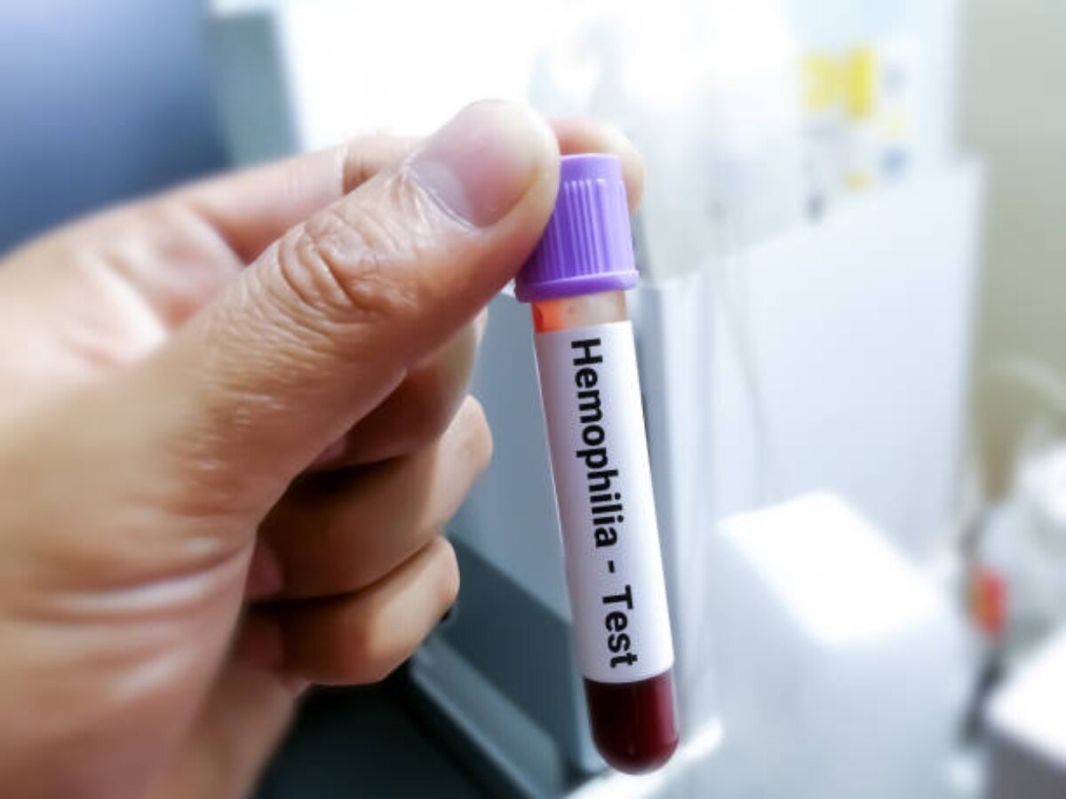 Hemoglobin Range in Male And Female Body why its necessary; Low ...