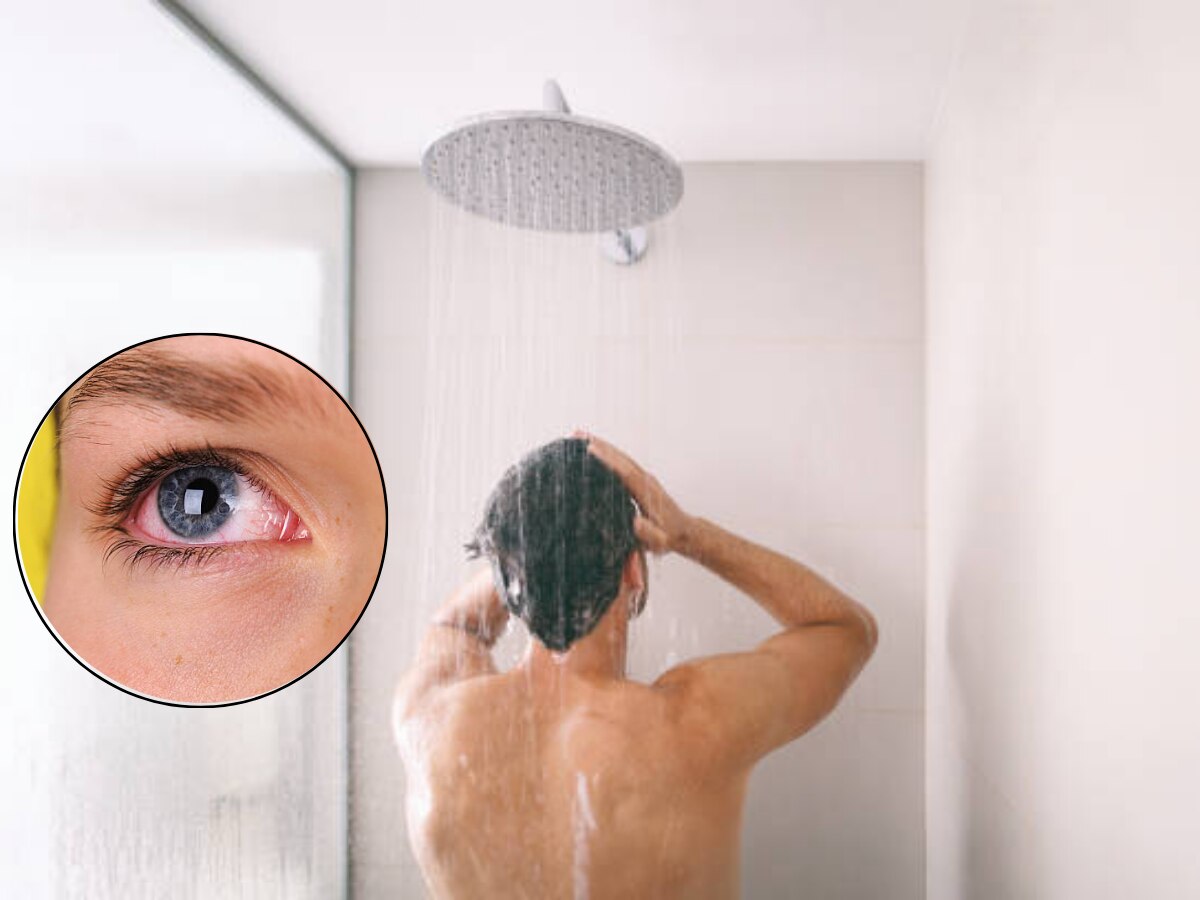 Why Eyes become red after bath Know the Cause And Reason; आंघोळीनंतर ...