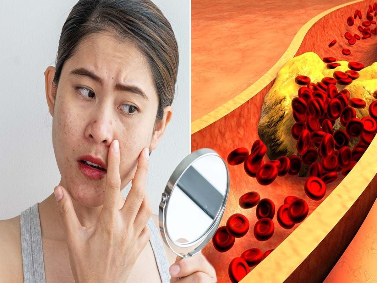 LDL Cholesterol Symptoms : 'ही' 6 लक्षणं तुमच्या चेहऱ्यावर दिसू लागली तर समजून जा, शरीरात वाईट ...