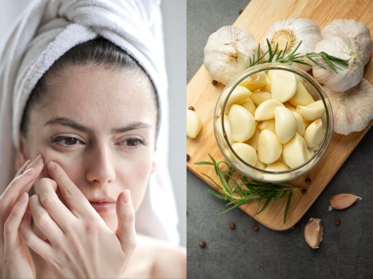 Garlic For Skin : लसणाची फक्त एक पाकळी वाढवेल तुमच्या त्वचेचं सौंदर्य ...