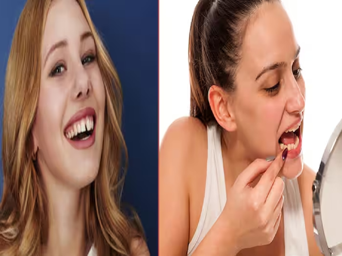 दातांमध्ये गॅप असणे शुभ की अशुभ? काय सांगत दातांमधील अंतर... | gap ...