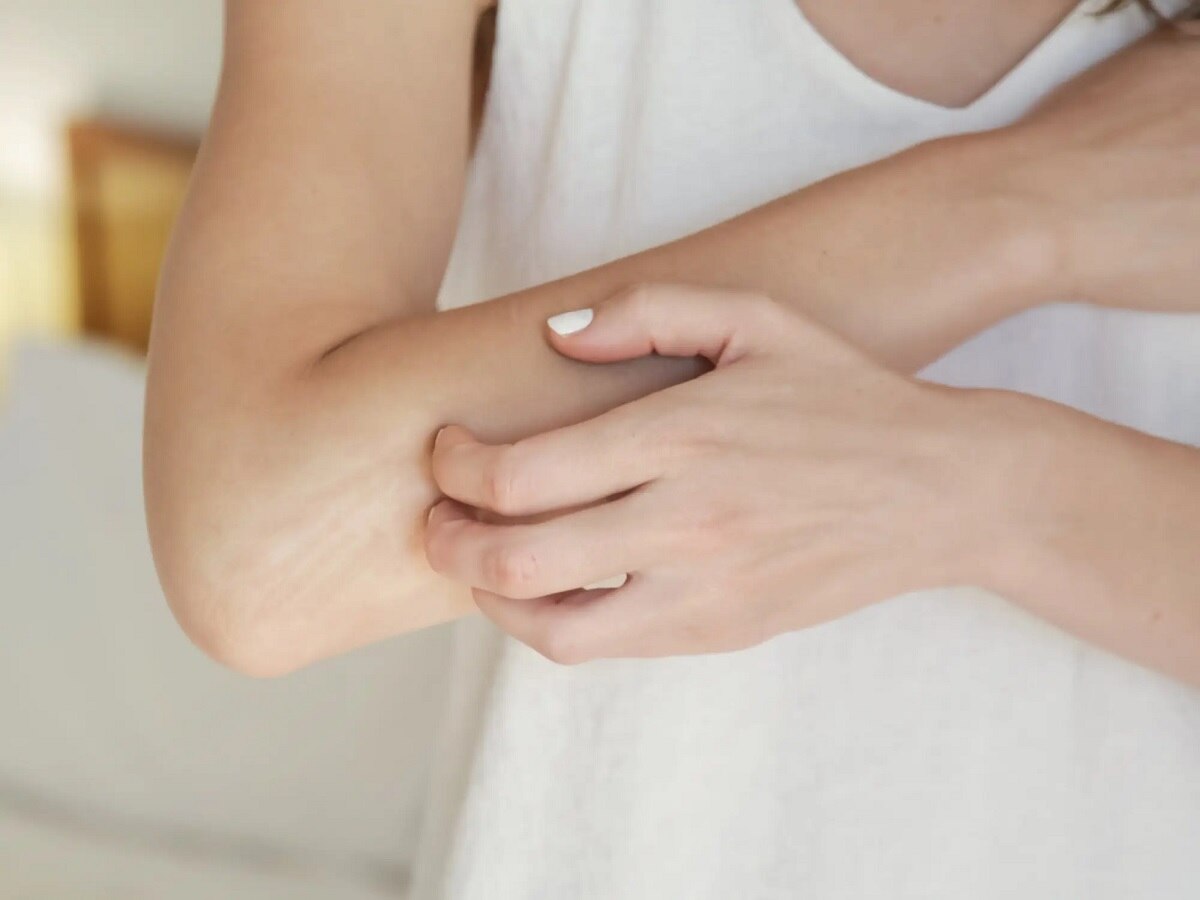 हिवाळ्यात त्वचेला खूप खाज येतेय का? 'हा' उपाय करा मिळेल आराम | how to ...