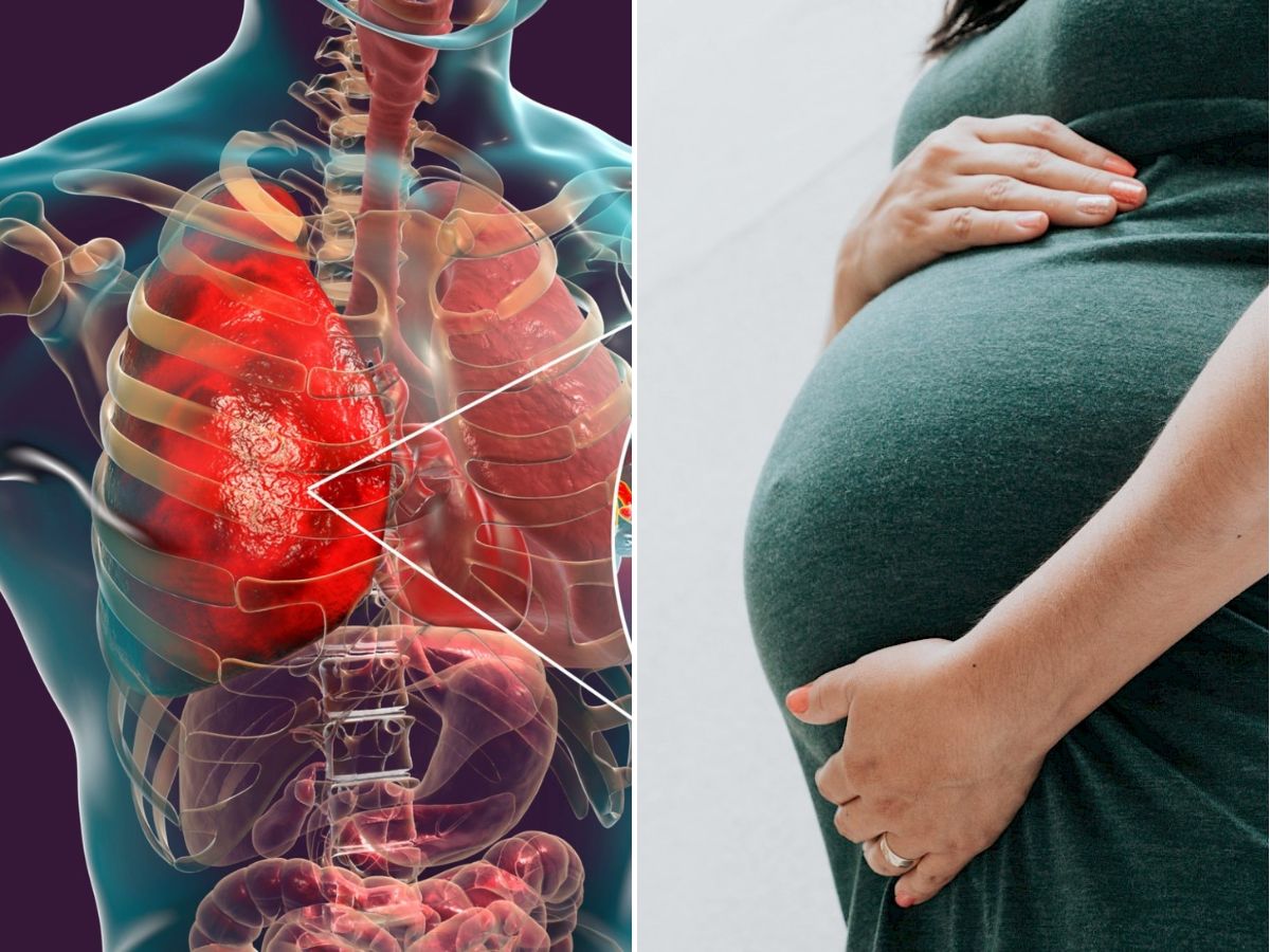 World TB Day 2025 Can Women with tuberculosis get pregnant What expert ...