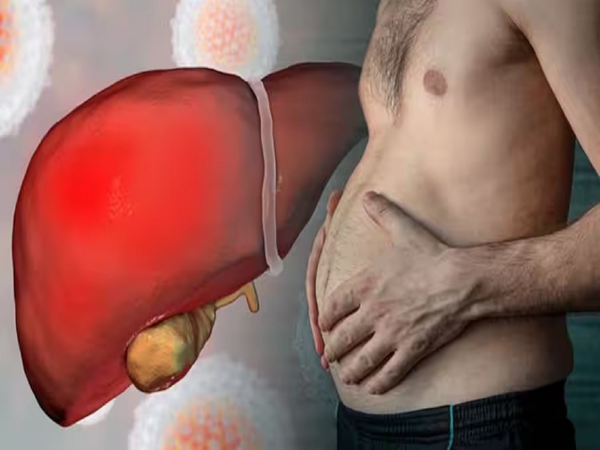 What are the symptoms of enlarged liver | शरीरातील 'हे' 5 बदल लिव्हरचा आकार वाढल्याची लक्षणं ...
