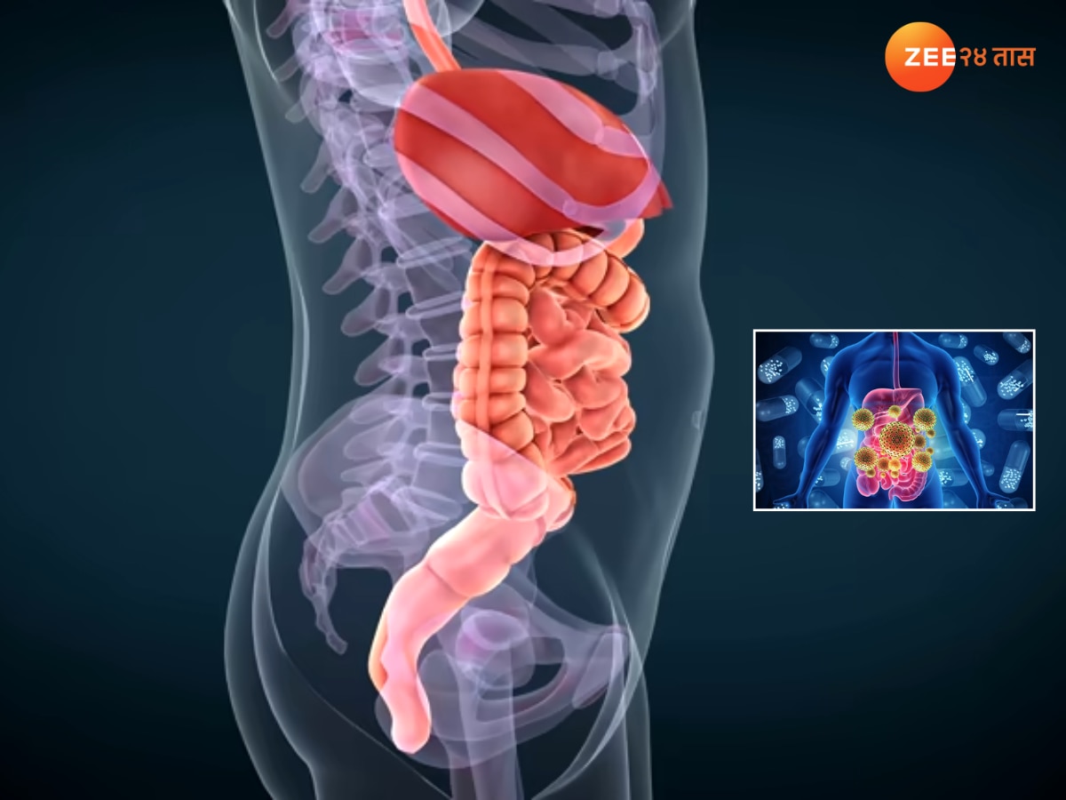 5 foods can clean your intestines and colon naturally prevent ...