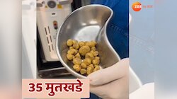 35 stones removed from bladder News in Marathi, 35 stones removed from ...