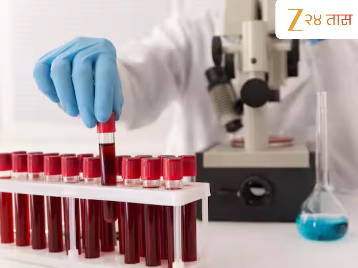 Which is Worlds Rarest Blood Group Found In One Person On Earth Gwada ...