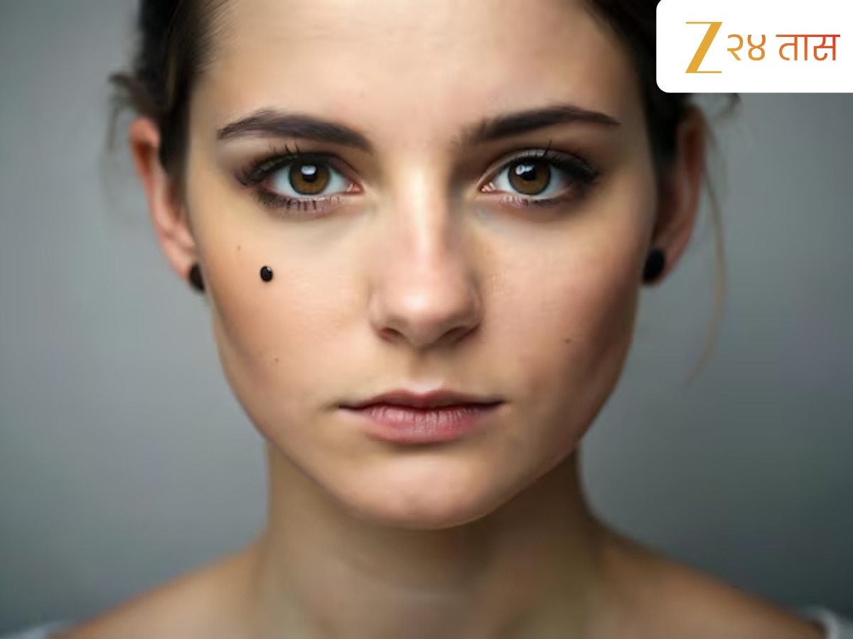 Samudrik Shastra: Meaning of Mole on Cheeks Is It Auspicious or ...