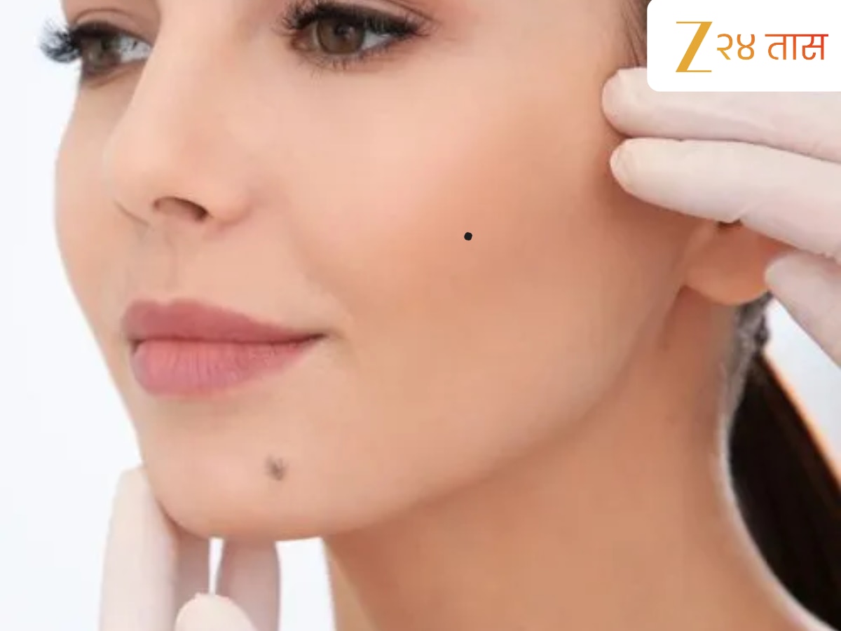 Samudrik Shastra: Meaning of Mole on Cheeks Is It Auspicious or ...
