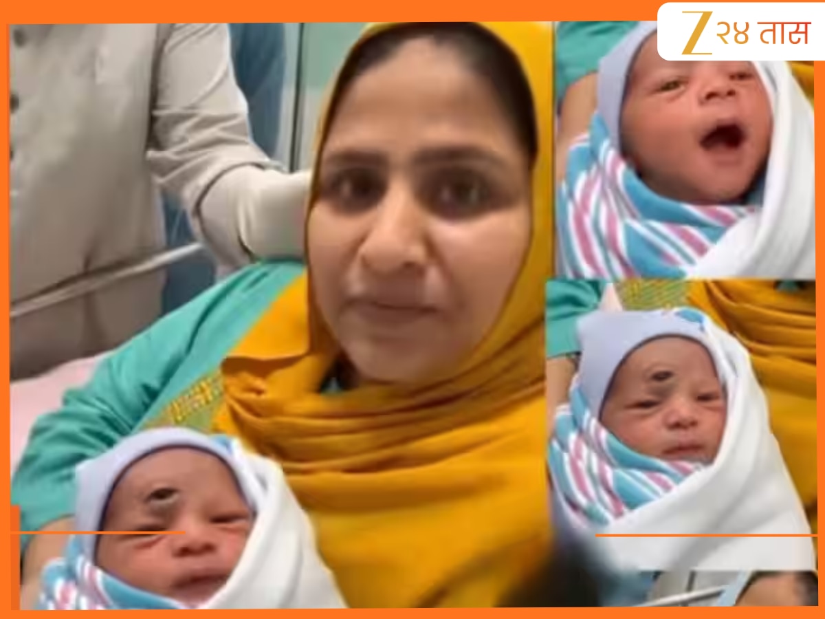 Three-Eyed Baby Birth Viral on Social Media: Experts Confirm AI ...