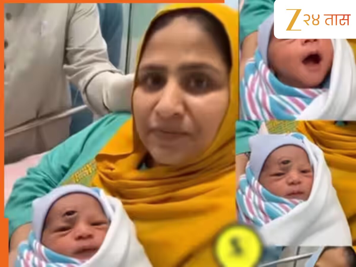 Three-Eyed Baby Birth Viral on Social Media: Experts Confirm AI ...