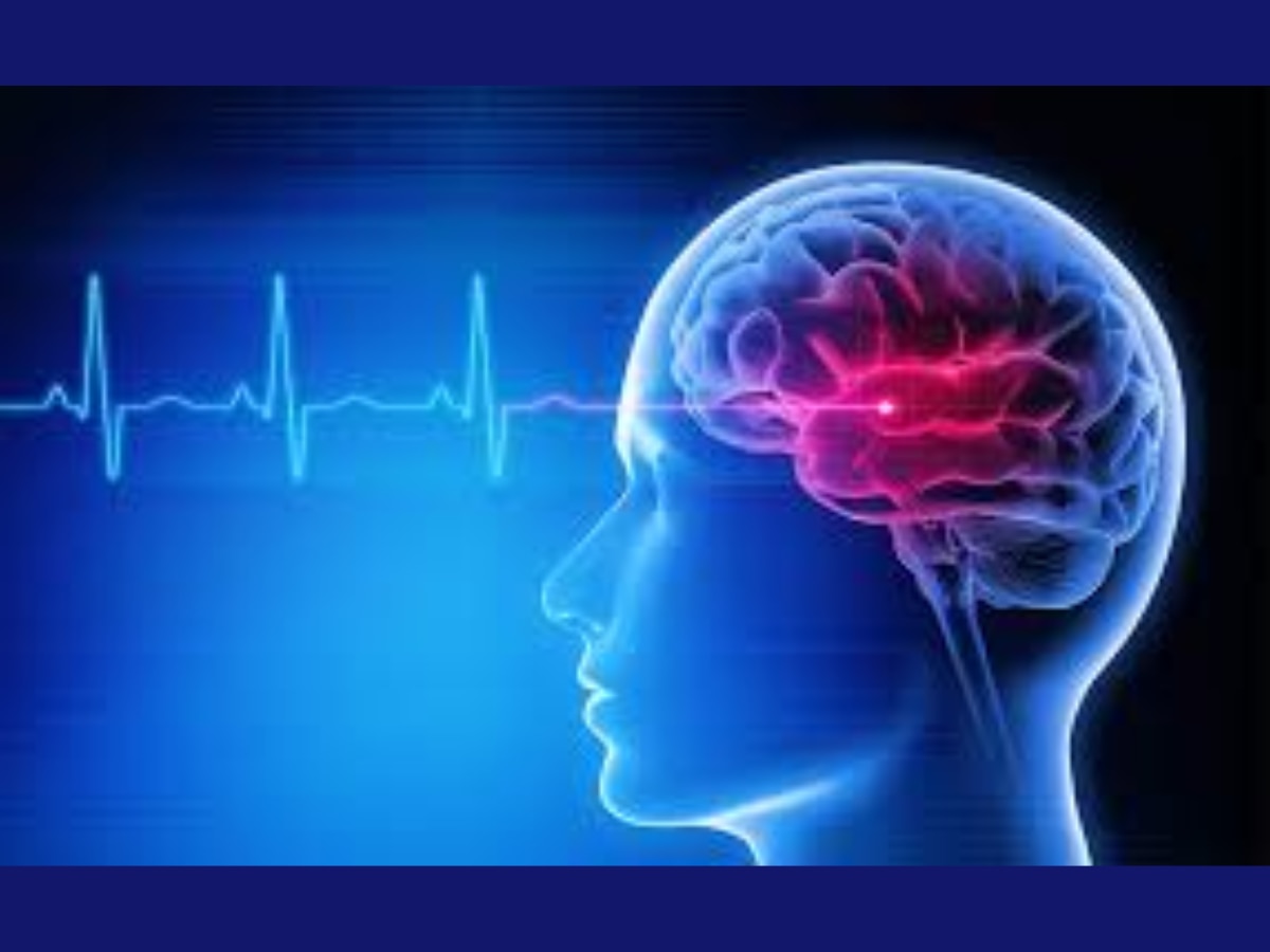Never ignore these 6 Stroke symptoms its affect you badly health news ...