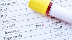 What is the normal range for HDL and LDL News in Marathi, What is the ...
